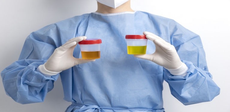 Culture vs. Routine Urine Test: What’s the Difference and When to ...