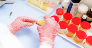 Culture vs. Routine Urine Test: What’s the Difference and When to ...